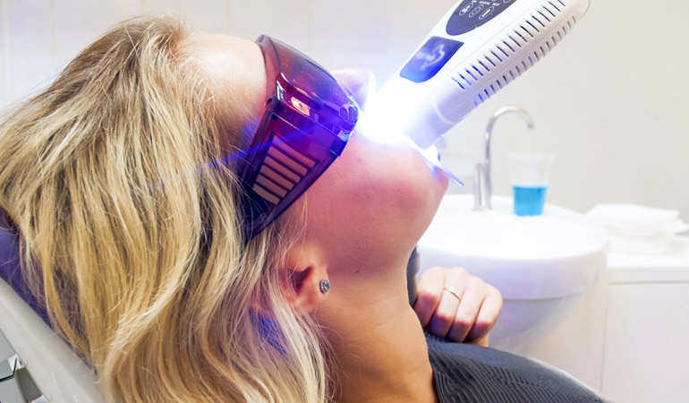Understanding the Process of Laser Teeth Whitening - Fort York Dentist